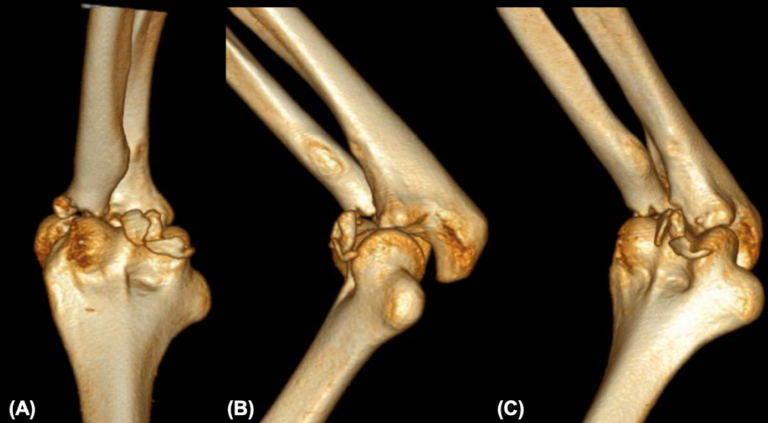 Best Elbow Joint CT Scan Center Near Me Nanded City in Pune
