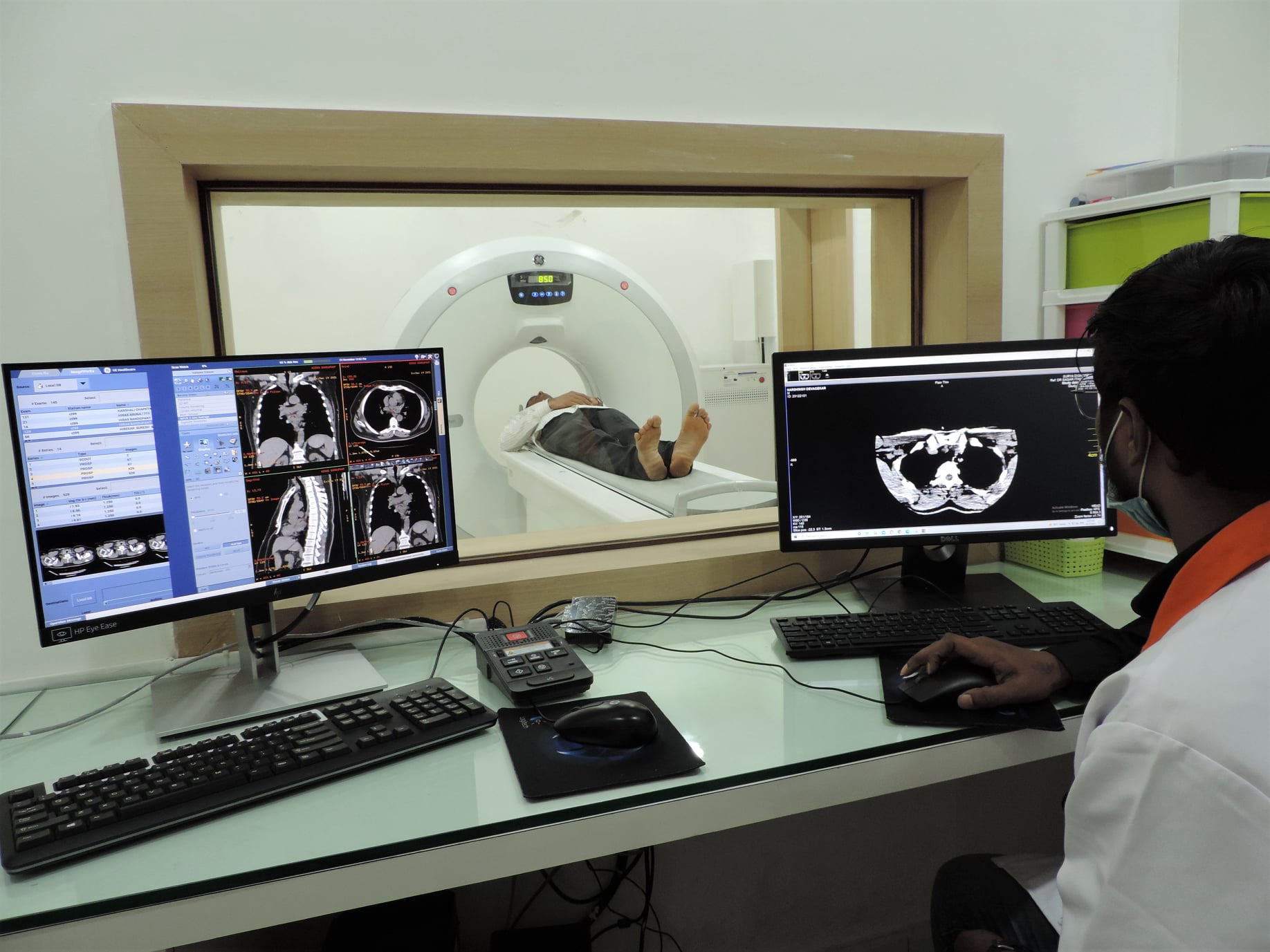 FISTULOGRAM - SURYA DIAGNOSTIC CENTER